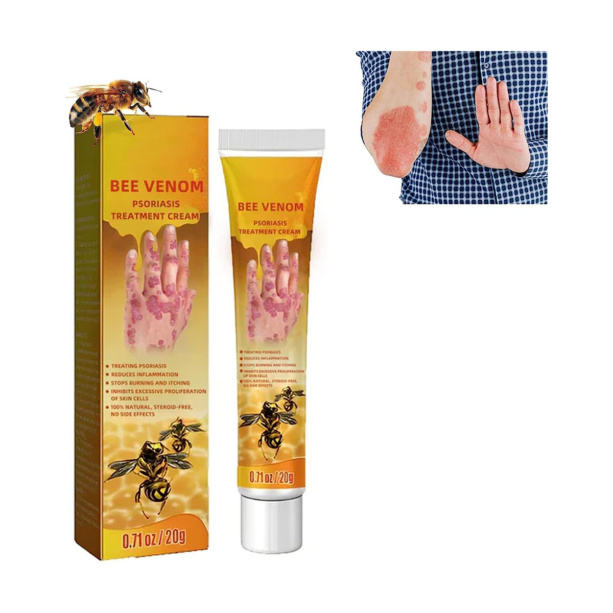 Sumifun Bee Venom Psoriasis Cream - 20g – QasrJamal