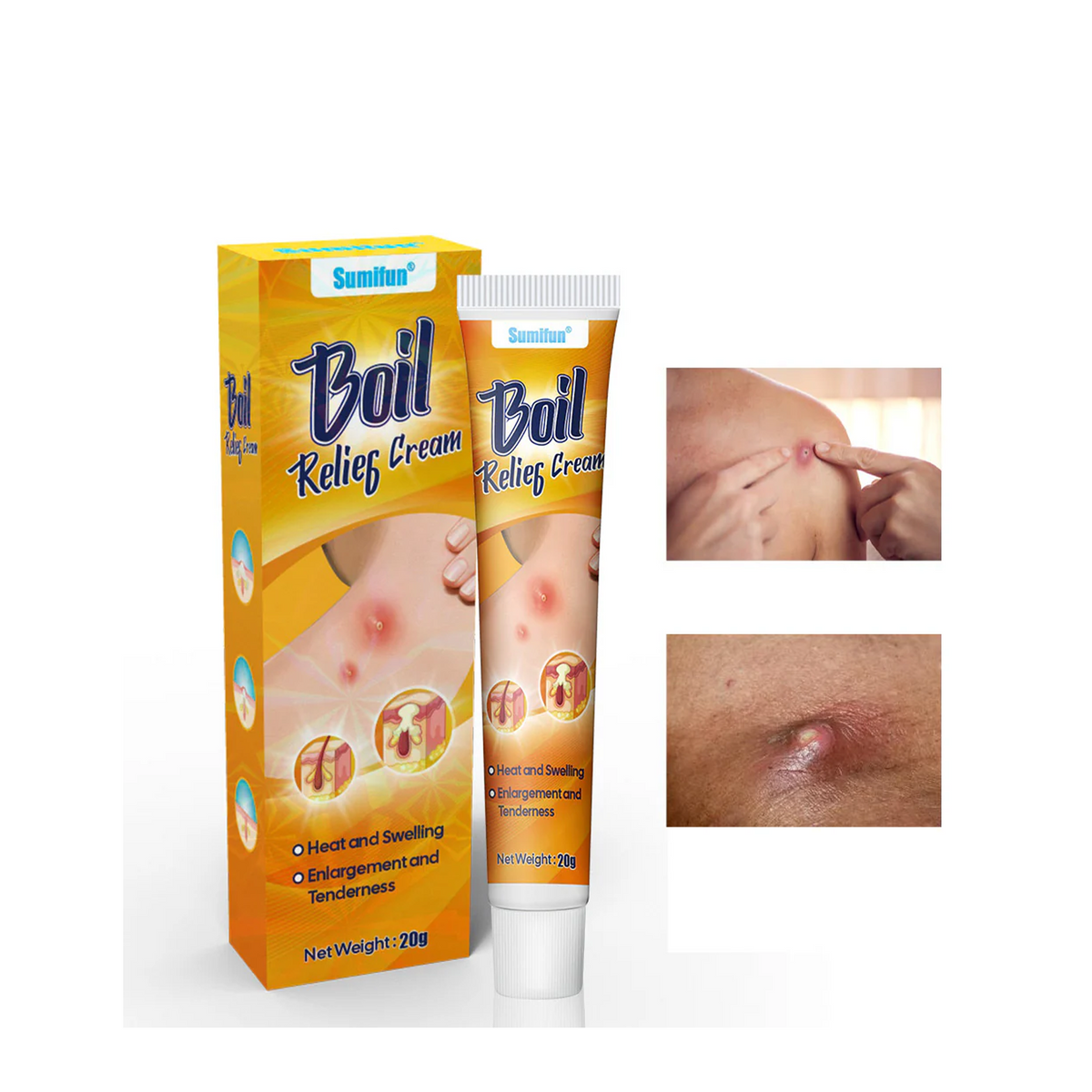 Sumifun Boil Relief Cream - 20g – QasrJamal